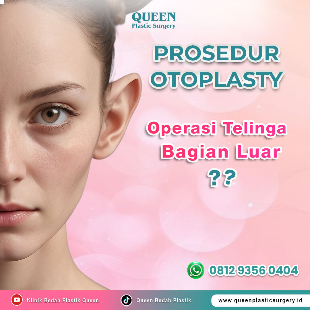 PROSEDUR DARI OTOPLASTY (OPERASI TELINGA LUAR) - Queen Klinik Kecantikan
