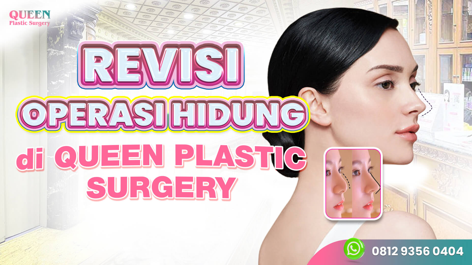 Prosedur Bedah Hidung Revisi di Queen Plastic Surgery - Queen Klinik Kecantikan